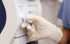 ¿Qué es la gasometría arterial? – Homo medicus