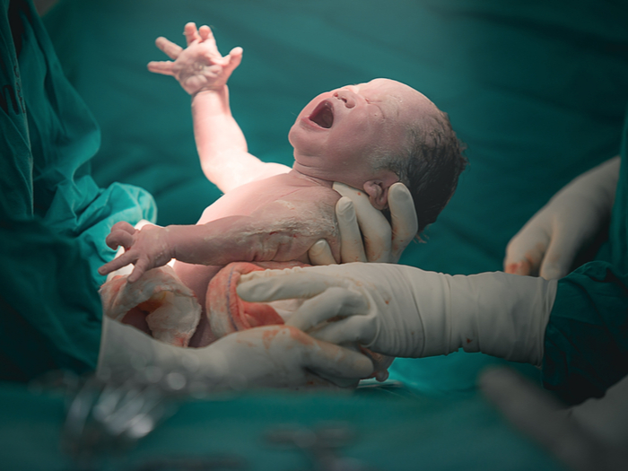 Mecanismo de parto normal - Obstetricia - Homo medicus