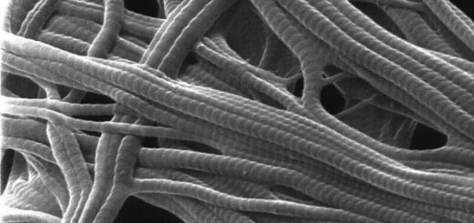 ¿Qué son las fibras reticulares del tejido conjuntivo?