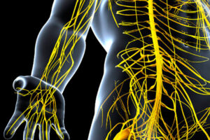 Causas de la polineuropatía simétrica distal – Homo medicus