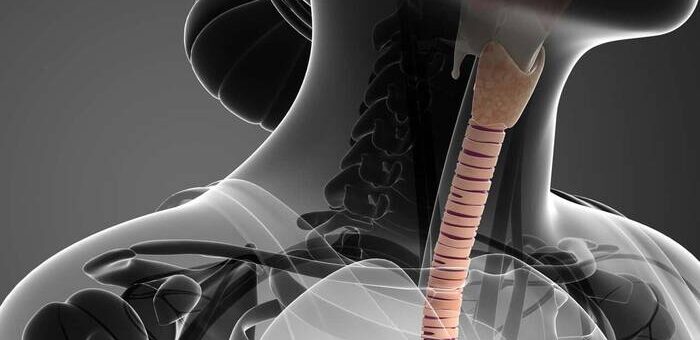 tráquea - Homo medicus