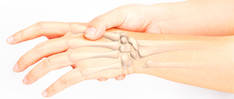 ¿Cuáles son los huesos del metacarpo? – Homo medicus