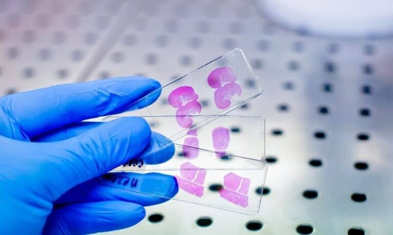 Técnica de tinción con hematoxilina & eosina – Homo medicus