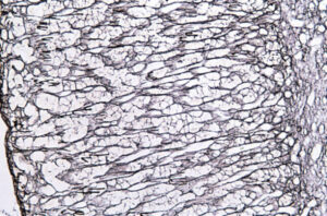 ¿Qué son las fibras reticulares del tejido conjuntivo? – Homo medicus