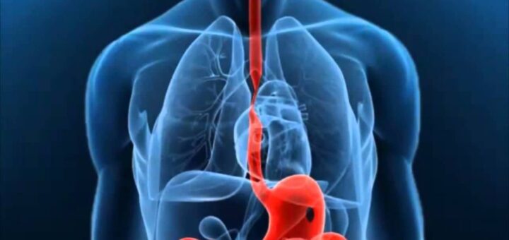 membranas esofágicas - Homo medicus