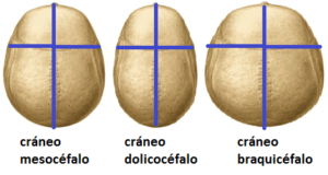 Como Se Clasifica El Cráneo Por Su Forma Homo Medicus