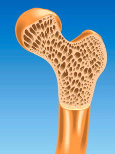 Periodos esenciales de la osteogénesis – Homo medicus