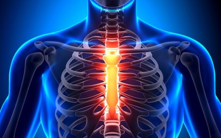 Desarrollo del esternón – Homo medicus