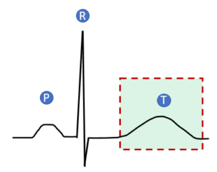 ¿Qué es la línea basal del electrocardiograma? – Homo medicus